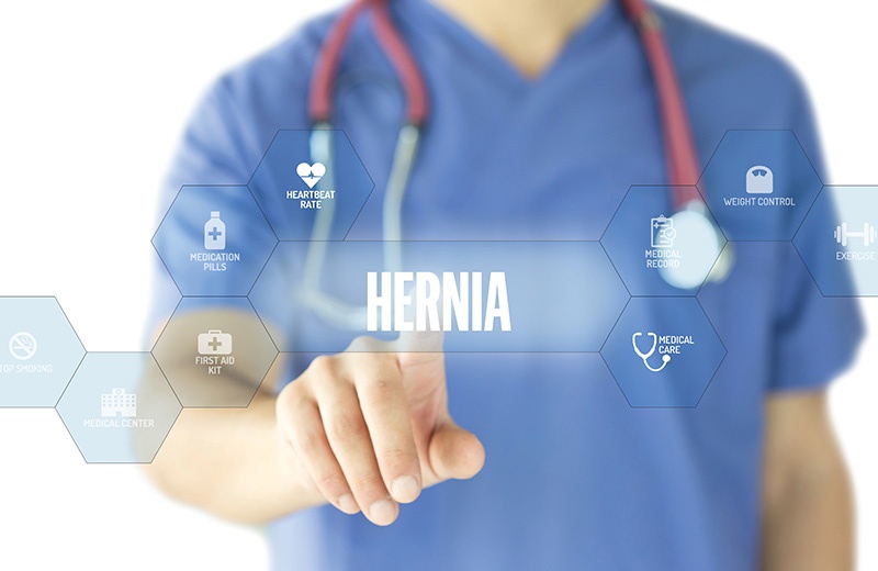 Hernia inghinală. Cauze, simptome și tratament | PortalMed